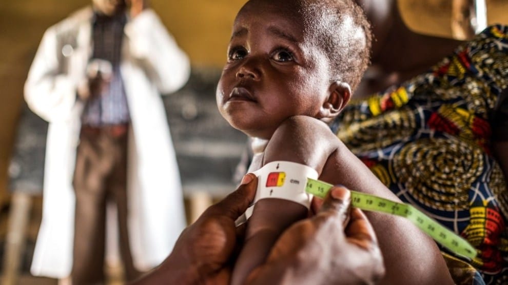 doenças causadas pela má alimentação-desnutrição - Nutri Mix ...